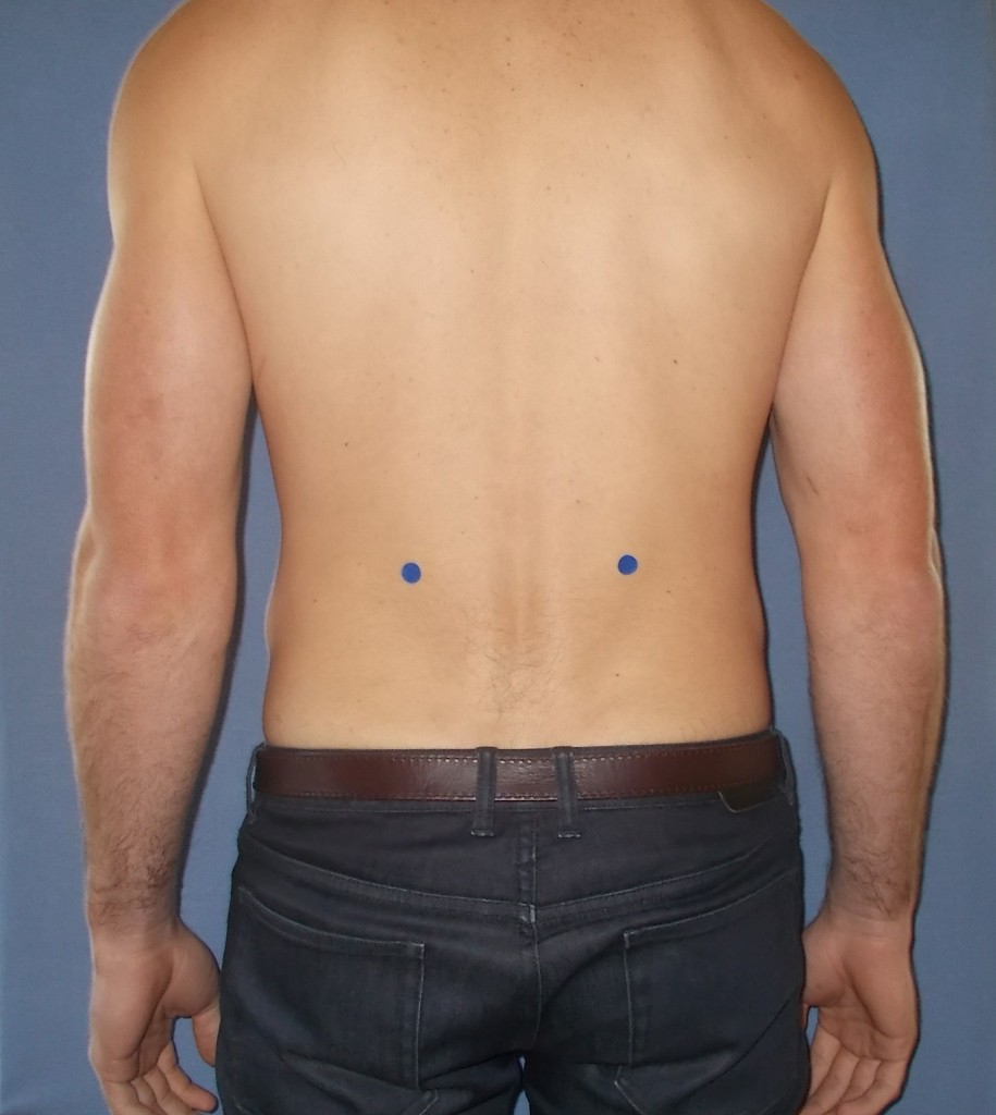 BL 52 | Five Element Acupressure