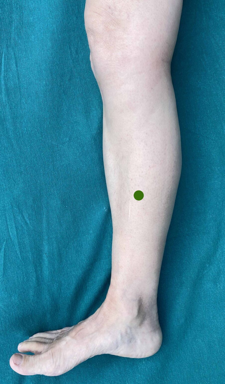 Anger | Five Element Acupressure