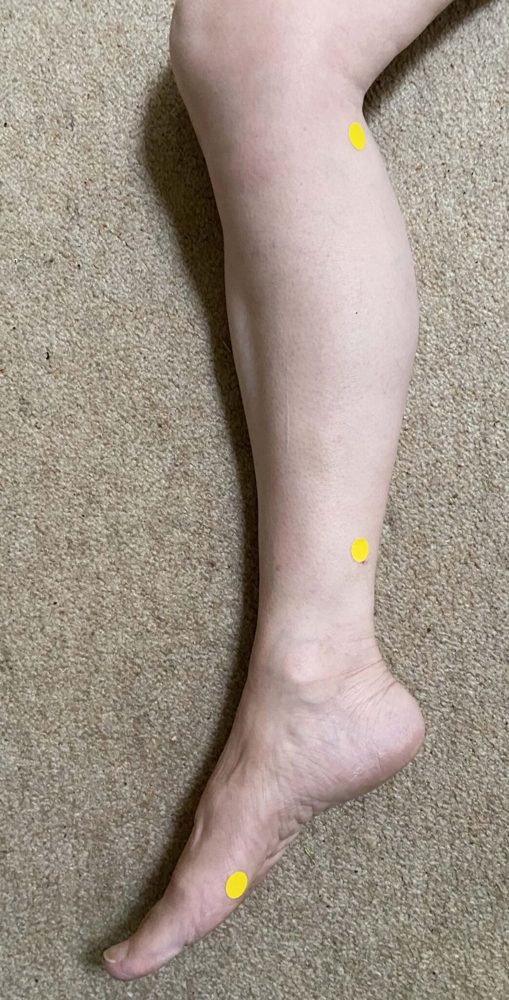 Urination | Five Element Acupressure